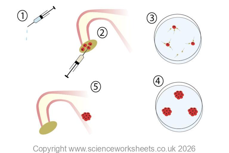 AQA GCSE Using hormones to treat infertility (Biology) - Science Worksheets